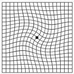 Buraco macular - Promácula - Dr. Nelson Chamma - Oftalmologista